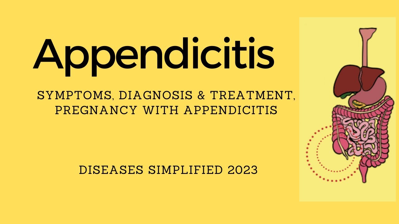 Appendicitis: symptoms, diagnosis & treatment. Pregnancy with ...