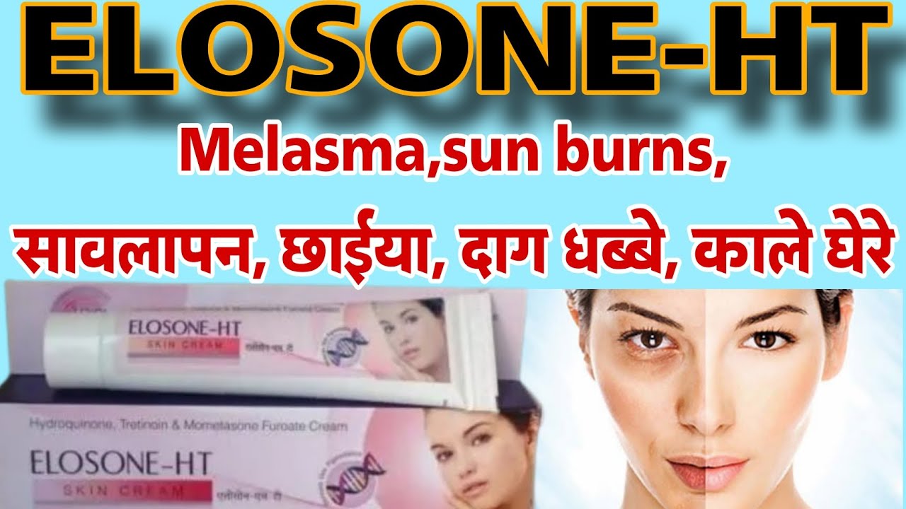 ELOSONE-HT|Melasma Treatment|Elosone ht Cream ke Use,Dose, Side effects ...