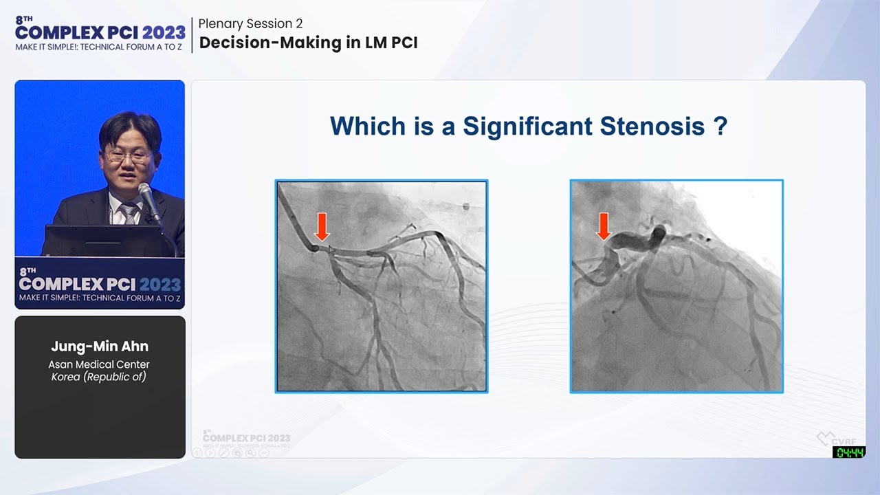 [COMPLEX PCI 2023] Plenary Session 2: Decision-Making in LM PCI - YouTube