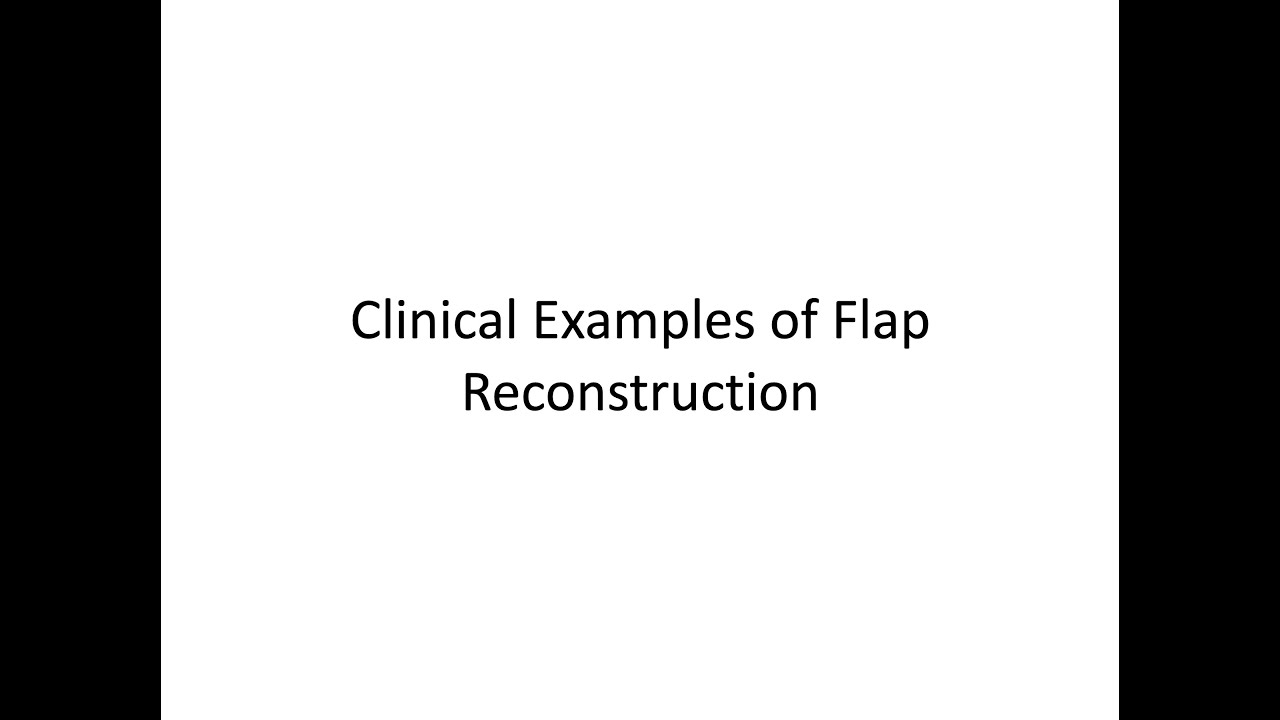 Clinical Examples of Flap Reconstruction - YouTube