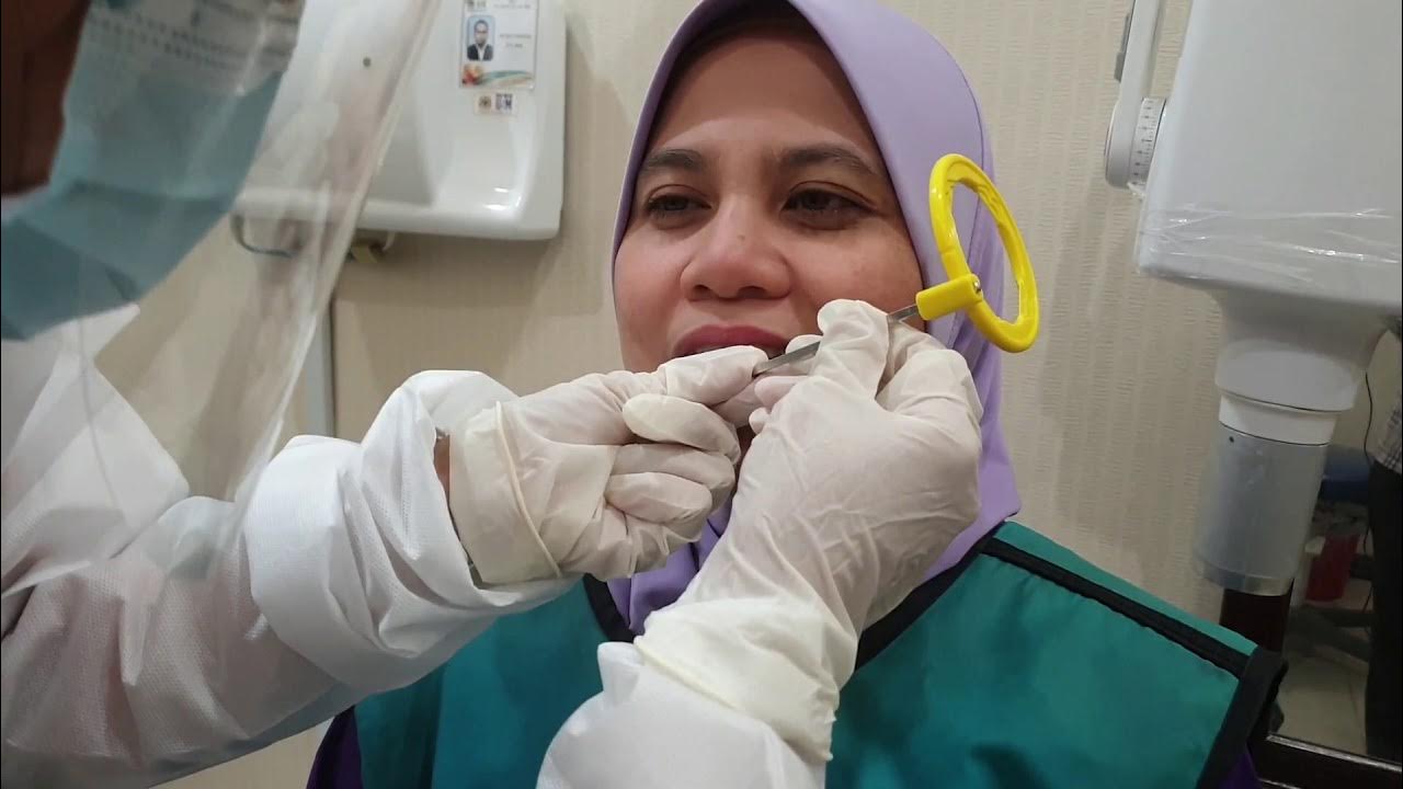 GNT208 - Taking periapical x-ray for posterior tooth - YouTube GNT208 - Taking periapical x-ray for posterior tooth - YouTube