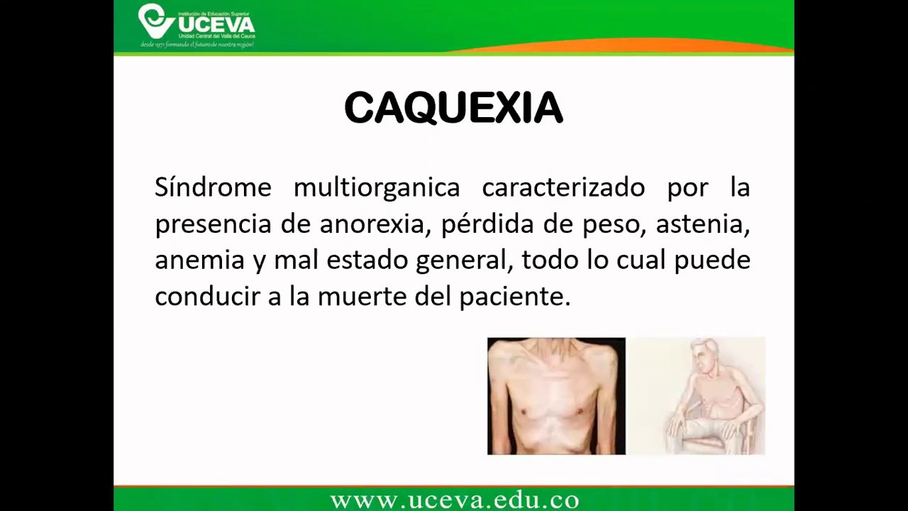 Manejo de los síntomas de Caquexia, Anorexia y Fatiga. - YouTube