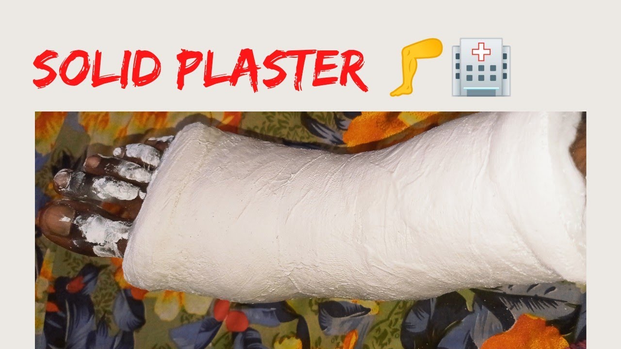 finally Aaj pakka plaster Ho hi Gaya. | #ravirajmehravlogs | # ...