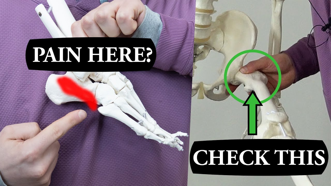 Peroneal Tendonitis Exercises - FAST RELIEF! (Comprehensive Guide ...