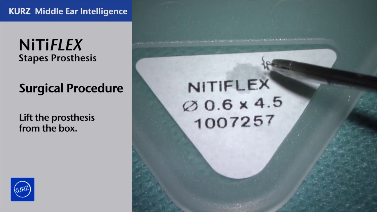 KURZ presents: NiTiFLEX Stapes Prosthesis - YouTube