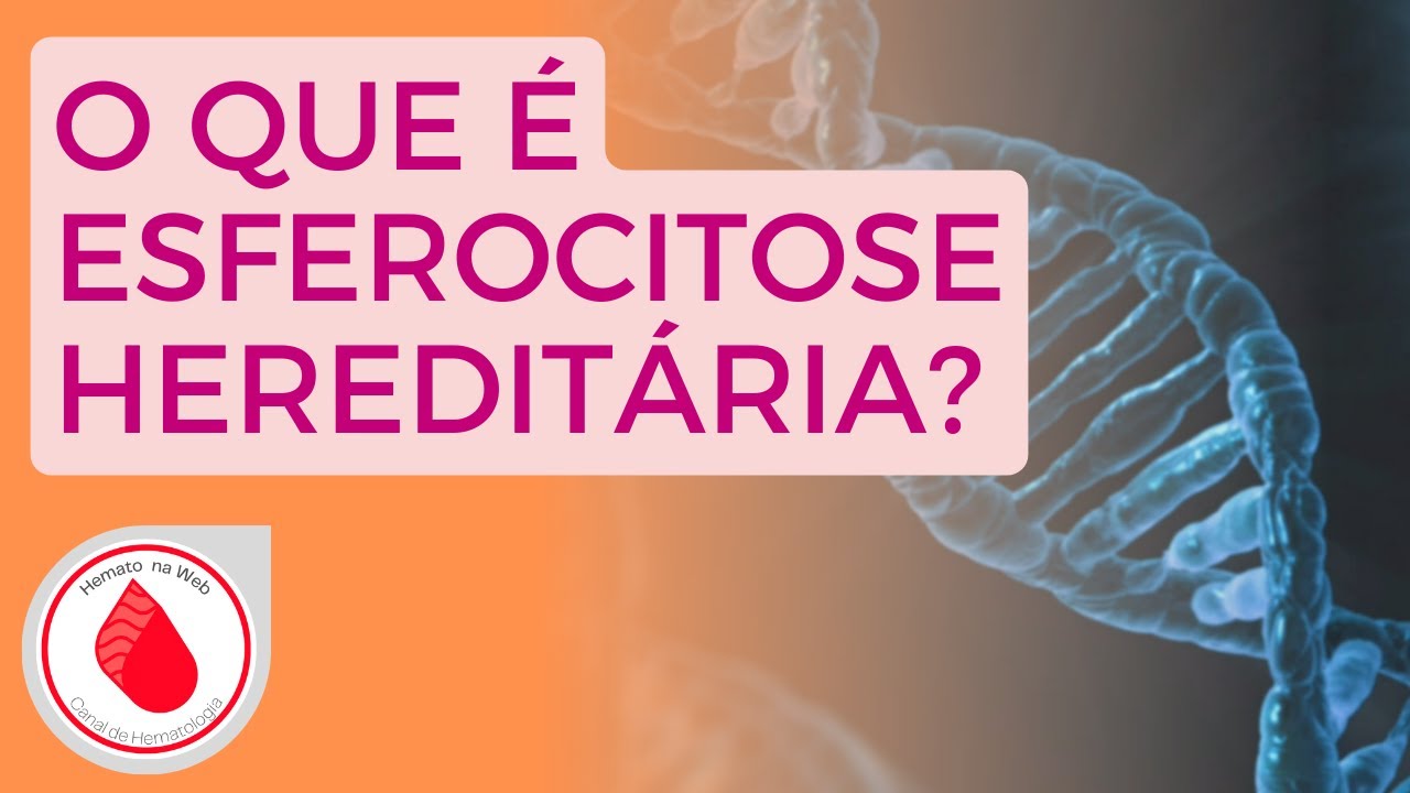 Conheça mais sobre ESFEROCITOSE HEREDITÁRIA! Esse curioso tipo de ...