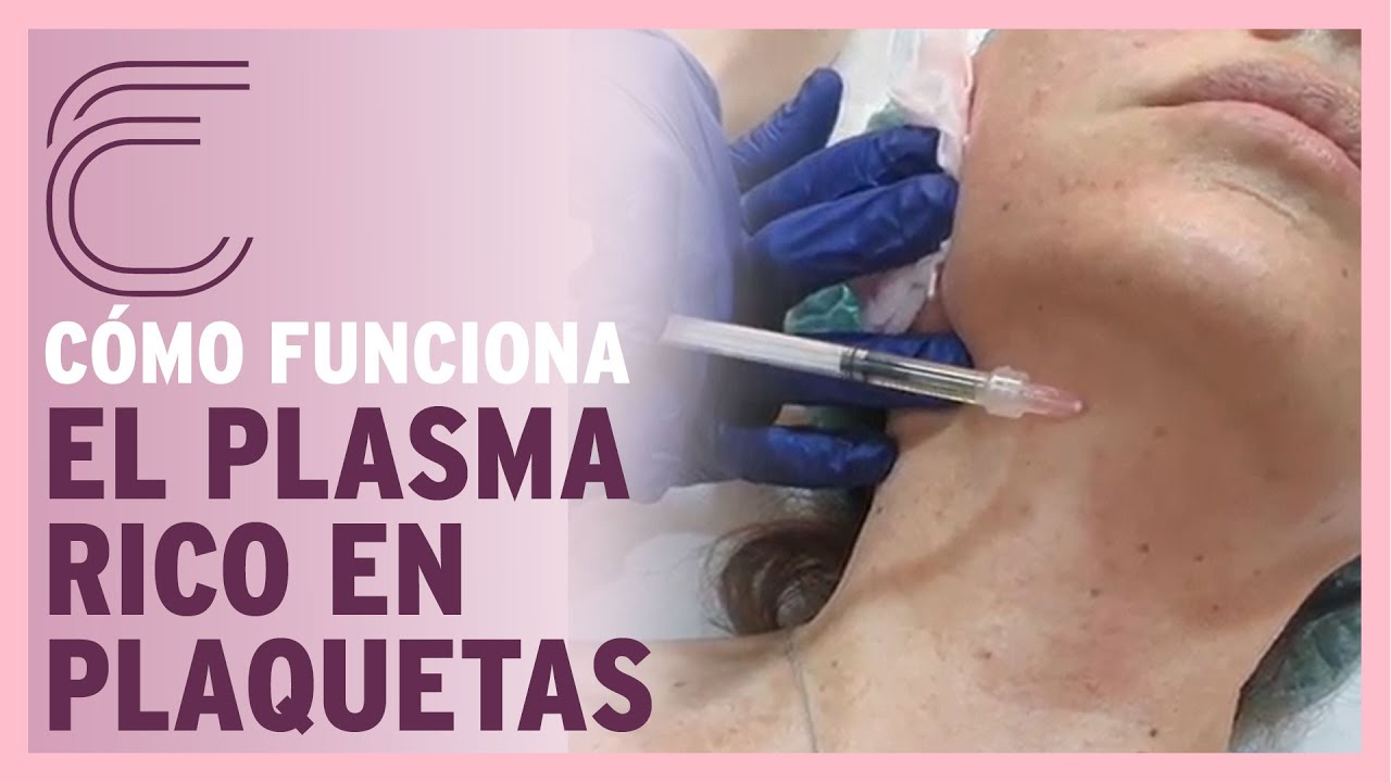 Cómo funciona el PRP - PLASMA RICO EN PLAQUETAS para la piel y el cuero ...