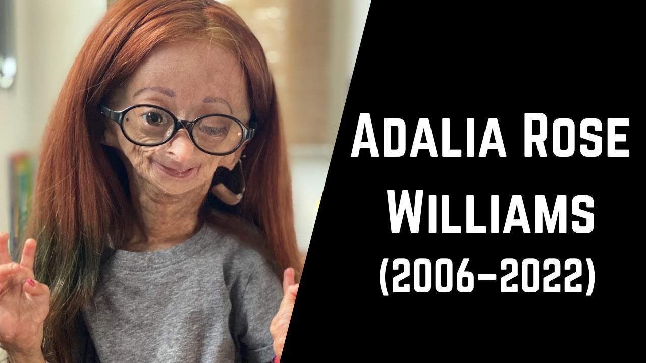Adalia Rose Williams - YouTube star with progeria - YouTube
