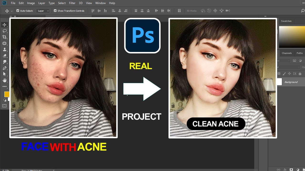 How To Clear Acne In Adobe Photoshop YouTube how-to-clear-acne-in-adobe-photoshop-youtube