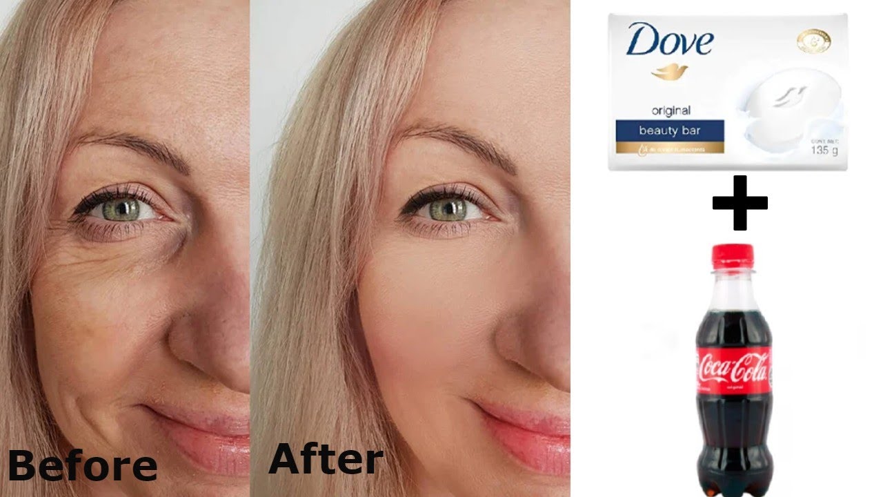 💯 Mix Dove Soap With Coca Cola and You Will Eliminate Wrinkles and Dead ...