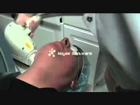 Spa ACCORD - Diod lazer uygulama videosu