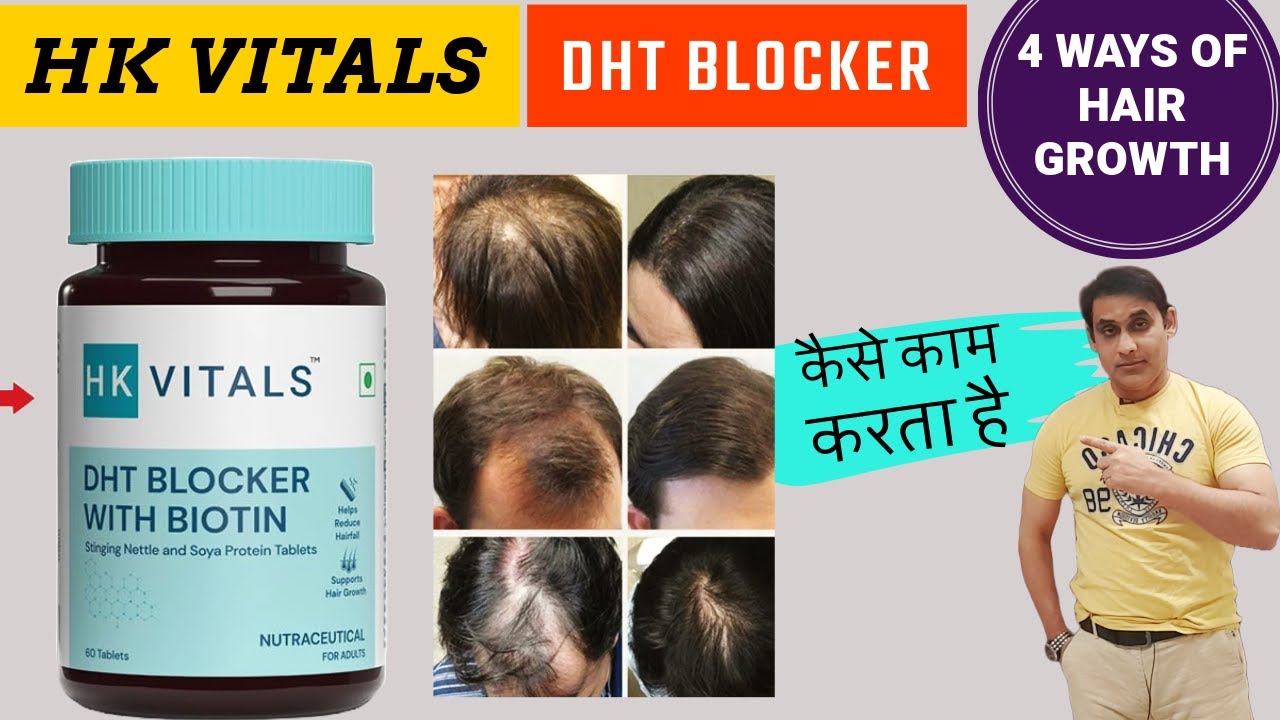 HK Vitals DHT Blocker Biotin Tablets REVIEW | How Healthkart HK Vitals ...