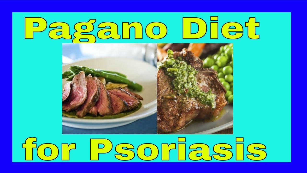 Pagano Diet for Psoriasis - YouTube
