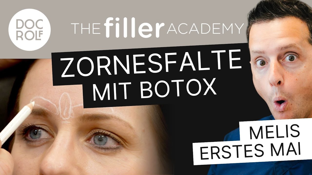 BOTOX SPRITZEN LERNEN: Die ZORNESFALTE – TFA by doc.rolf - YouTube