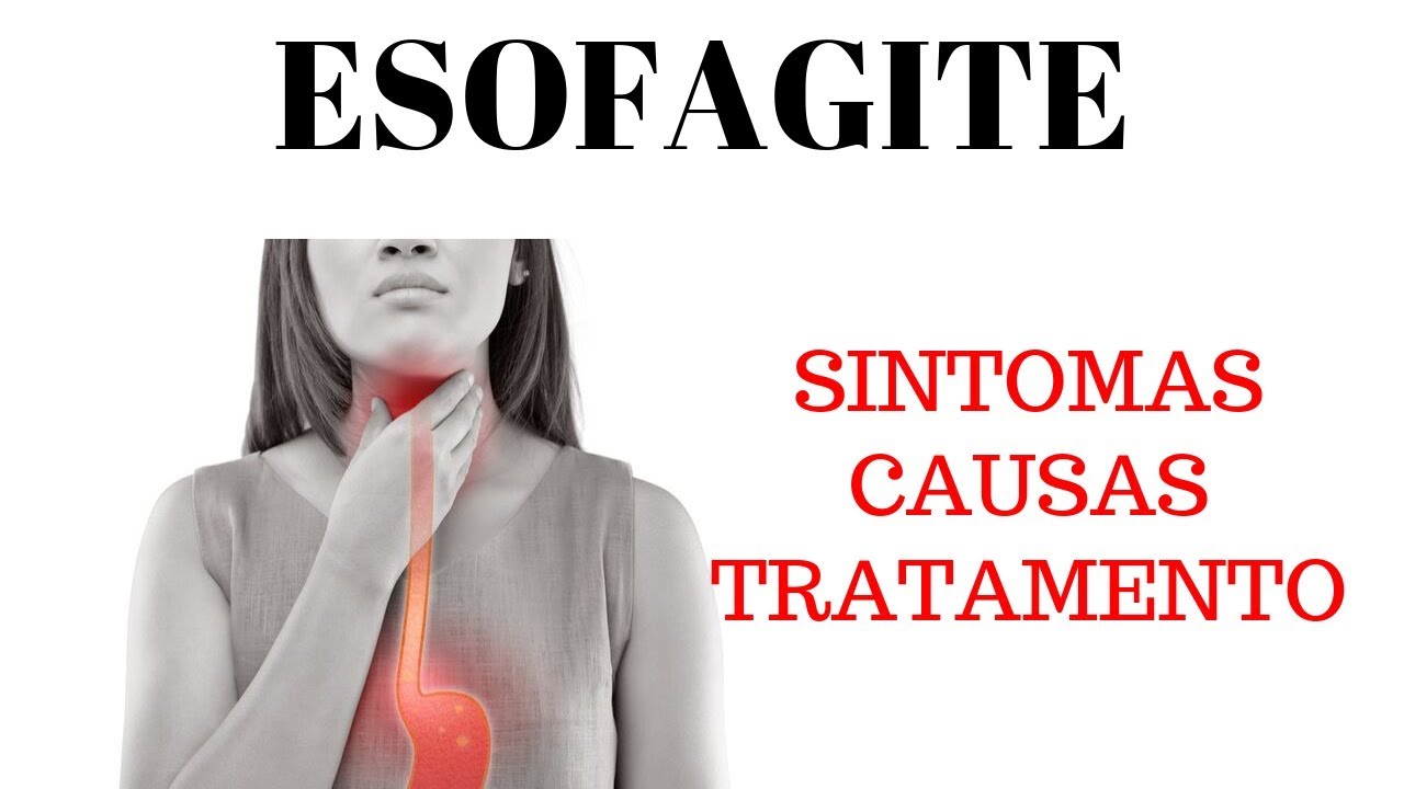 O QUE E ESOFAGITE? - YouTube