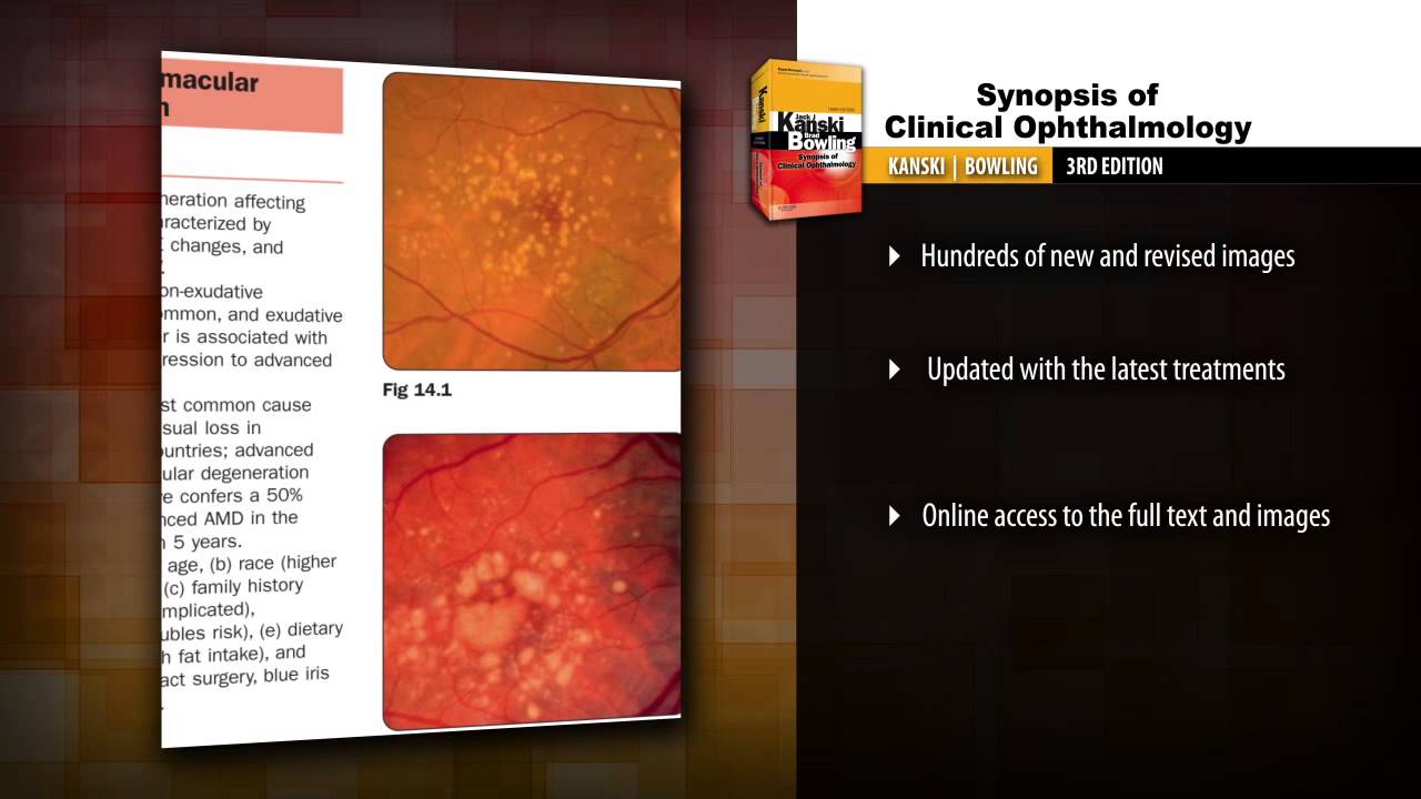 Synopsis of Clinical Ophthalmology, 3rd Edition - YouTube