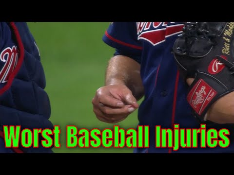 Worst baseball Injuries 6 - YouTube