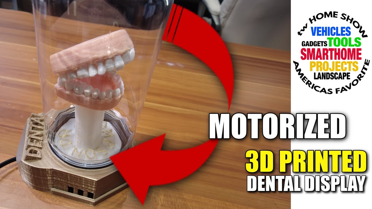 3D PRINTED – MOTORIZED Rotating Display | DENTAL – DENTIST Office ...