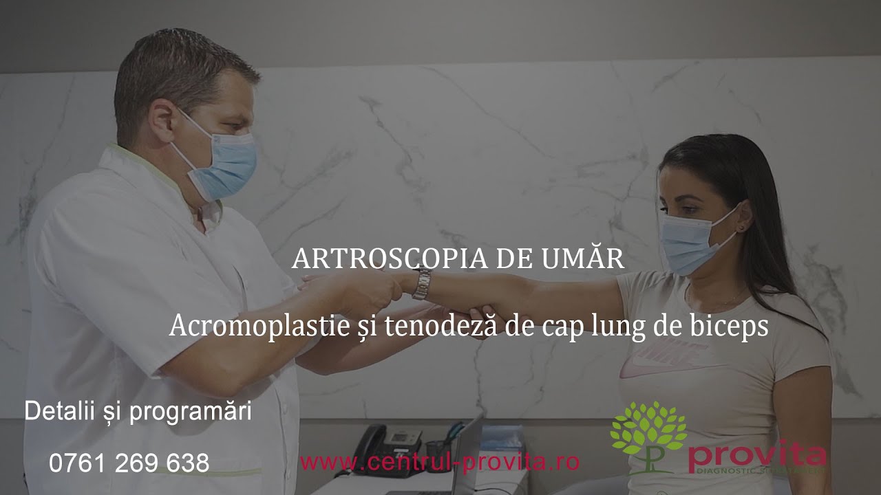 Testimonial artroscopia de umar (acromioplastie și tenodeză de tendon ...