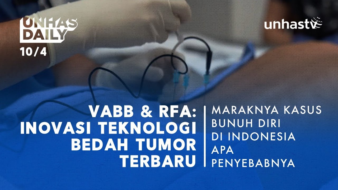 Unhas Daily 10/4 - VABB & RFA: Inovasi Teknologi Bedah Tumor Terbaru ...