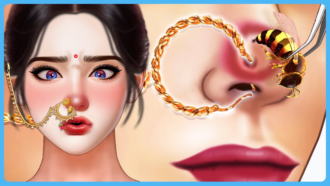 ASMR Satisfied with treatment of Bee sting on Nose and Remove Piercing ...