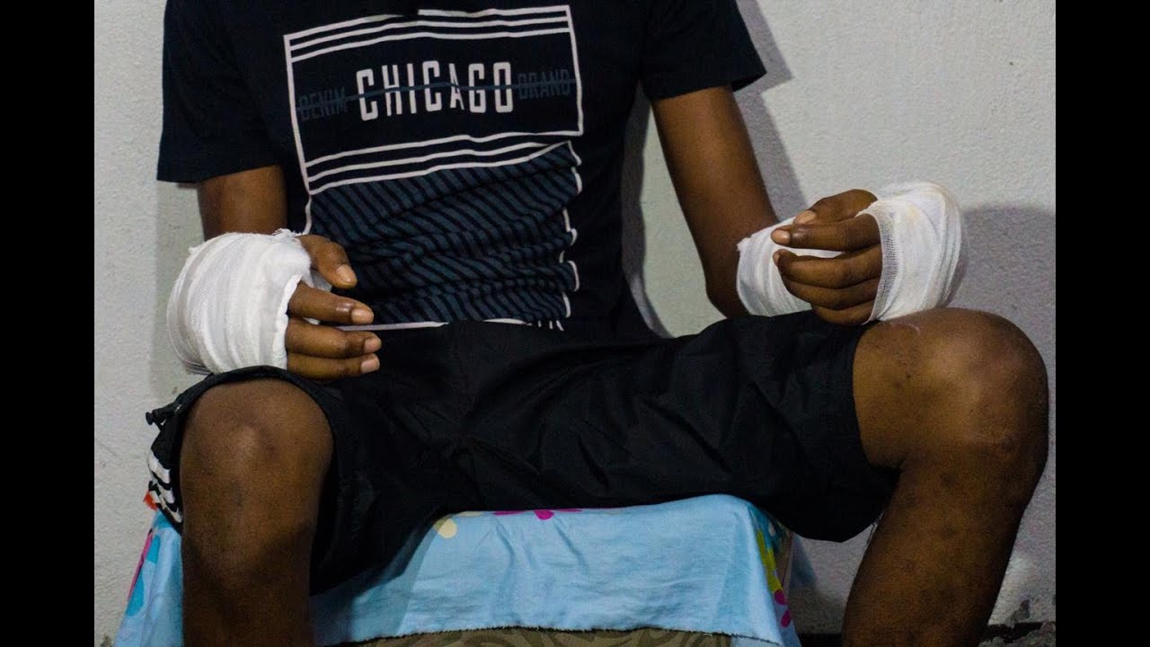 Habla el joven al que le amputaron una mano en calle de Cali - YouTube