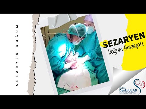 Sezaryen Doğum Anı (Gerçek Doğum)