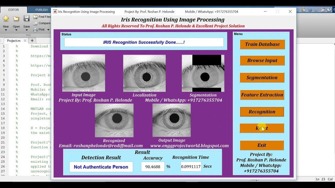 Iris Recognition Using Matlab Project | Iris Recognition Using Machine Learning Matlab Code ...