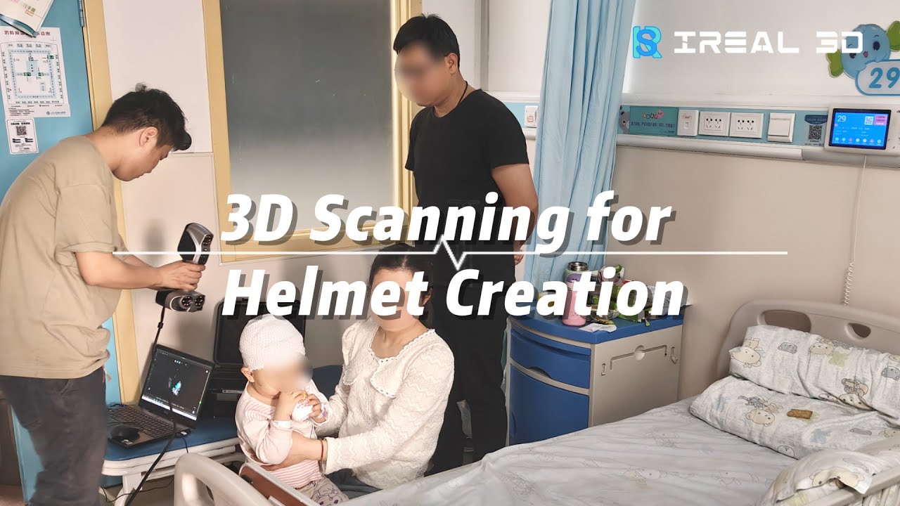 Enhancing Post-Craniotomy Care with iReal M3 3D Scanning for Helmet ...