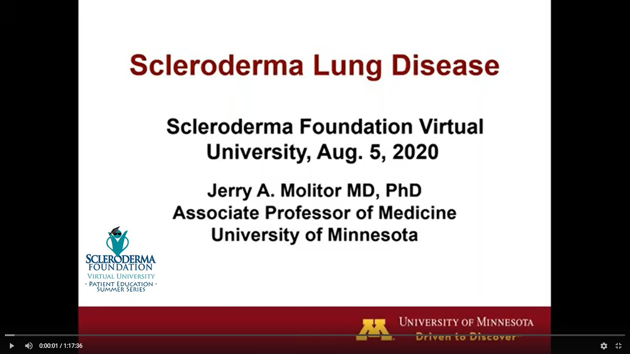 Scleroderma Lung Disease, Jerry Molitor, M.D., Ph.D., University of ...