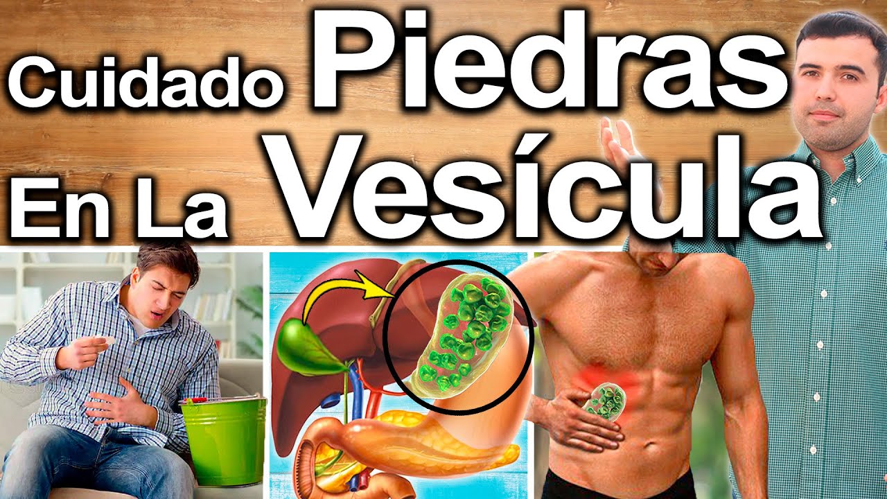 SÍNTOMAS QUE INDICAN PIEDRAS EN LA VESÍCULA - Cómo Saber Si Tienes ...