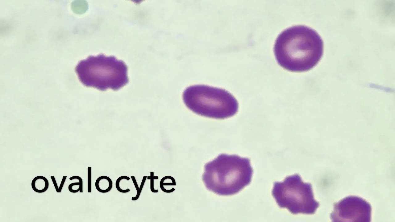 Ovalocytes