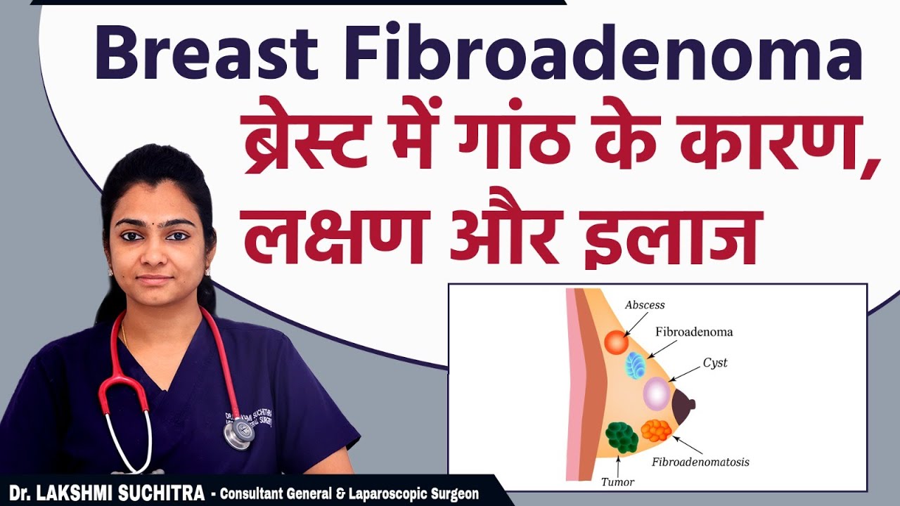 Fibroadenomatosis Fibroadenoma Abscess Tumor Cyst In The Ratan