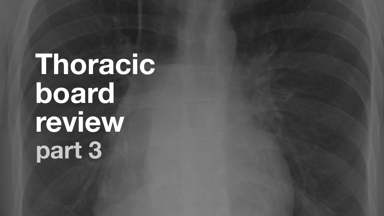 Board Review | Thoracic Radiology | Part 3 - YouTube