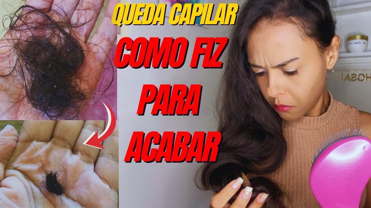 COMO ACABEI COM A QUEDA CAPILAR | MINHA EXPERIÊNCIA E DICAS VALIOSAS ...