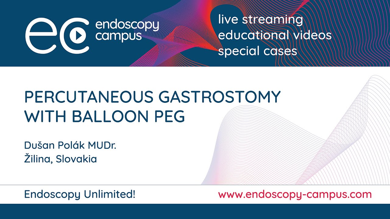 Percutaneous gastrostomy with balloon PEG - YouTube