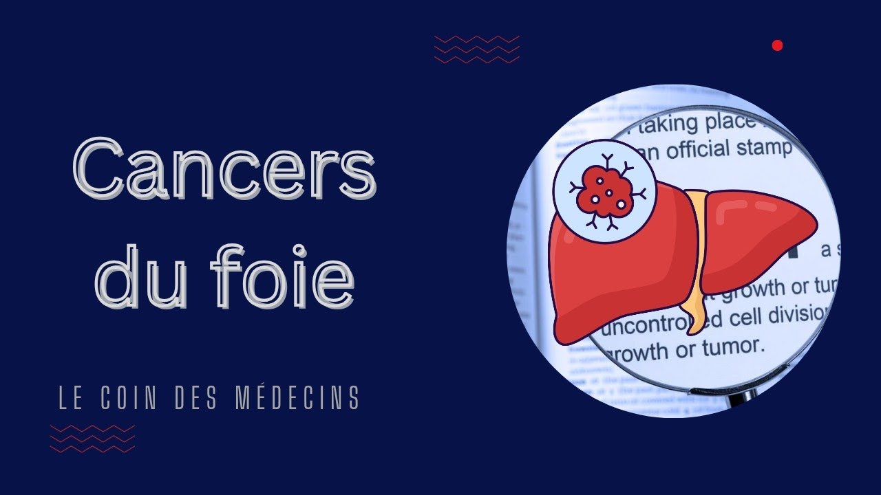 Cancers du foie - YouTube