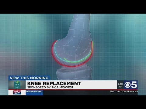 New technology makes it easier for knee replacement surgery - YouTube