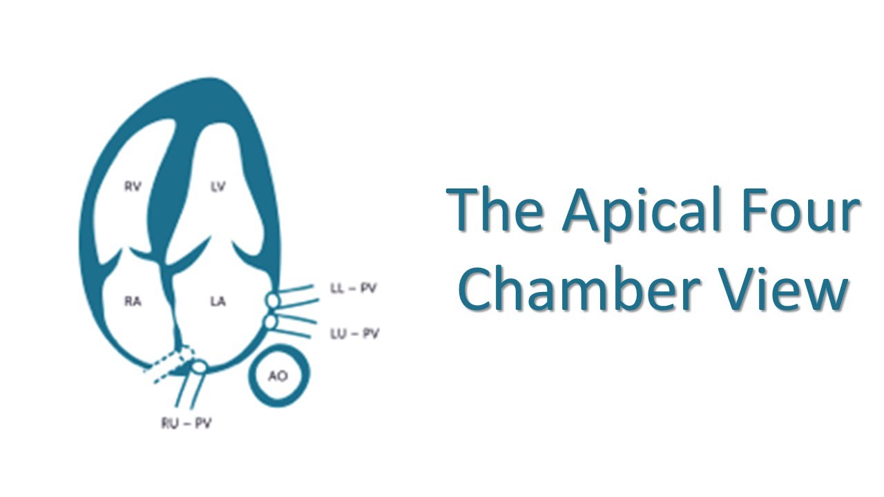 Apical Four Chamber View | Identifying the basic anatomy | Point of ...