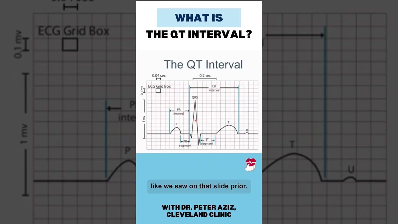 Qtc Interval Long QT Syndrome By G. Dhillon | OPENPediatrics