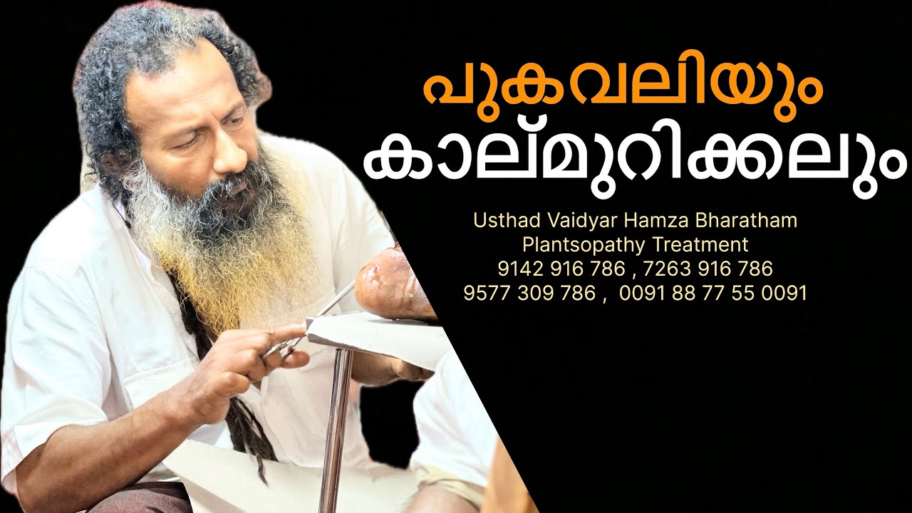 പുകവലിയും കാല്മുറിക്കലും Usthad Vaidyar Hamza BharathamPlantsopathy ...