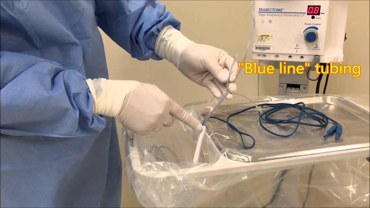 Trabectome Fast Setup - Temple Surgery Center - Yale New Haven Hospital ...