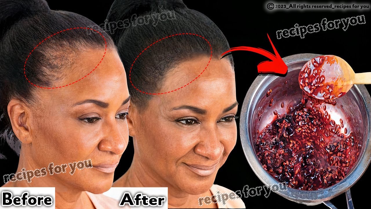 I tried this and my hair growth got doubled in 1 month-Increase Hair ...