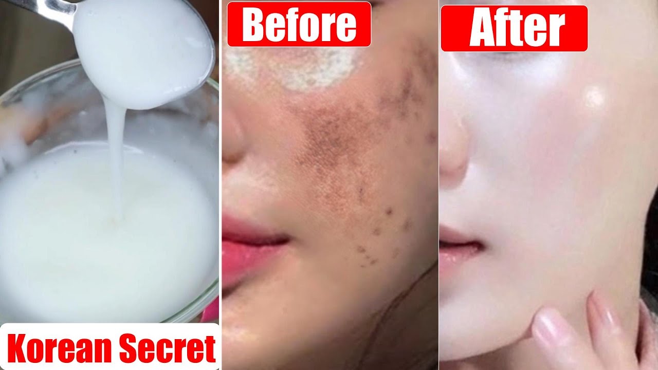 Secret Glass Skin Formula Cream-7 Days Challenge-ऐसे बनाये Korean Milk ...