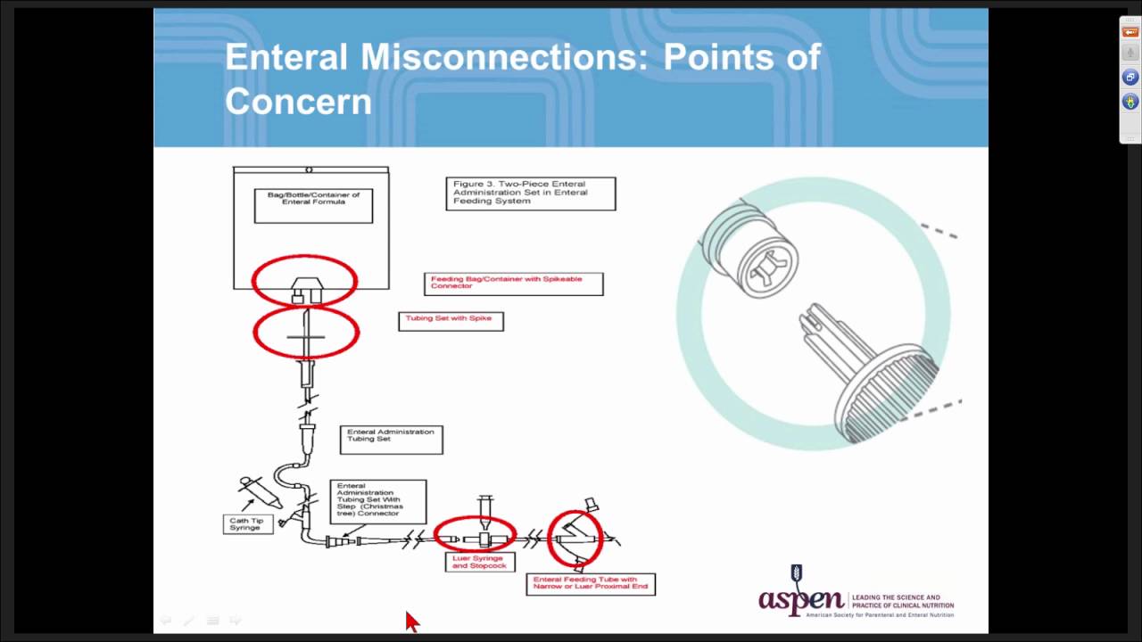 ENFit Adopting New Enteral Connectors 28 July 2016 - YouTube