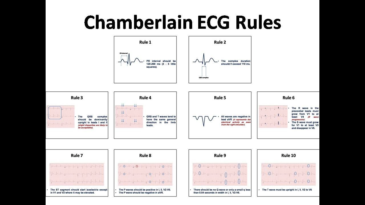 ECG Course Chamberlain ECG Rules Dr Sherif Altoukhy YouTube