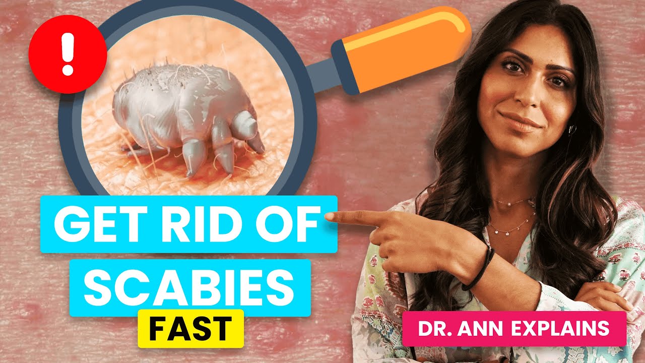 Scabies Treatment: How to Apply Permethrin & Stop Reinfection (Doctor’s ...