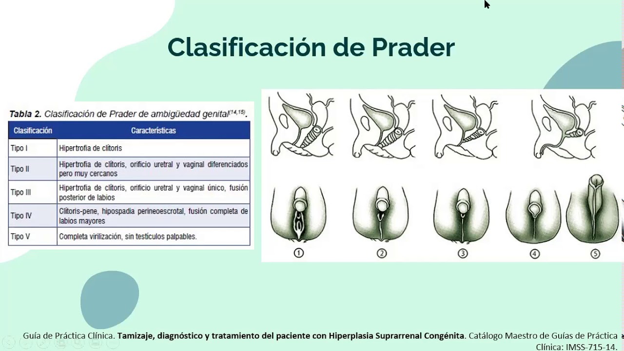Endocrinología // Hiperplasia Suprarrenal Congénita Pt. 2 // 19 de ...