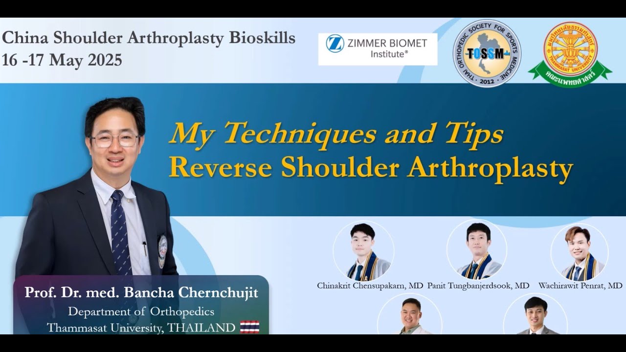 RTSA Reverse Total Shoulder Arthroplasty Tips Tricks Prof.Dr.med ...