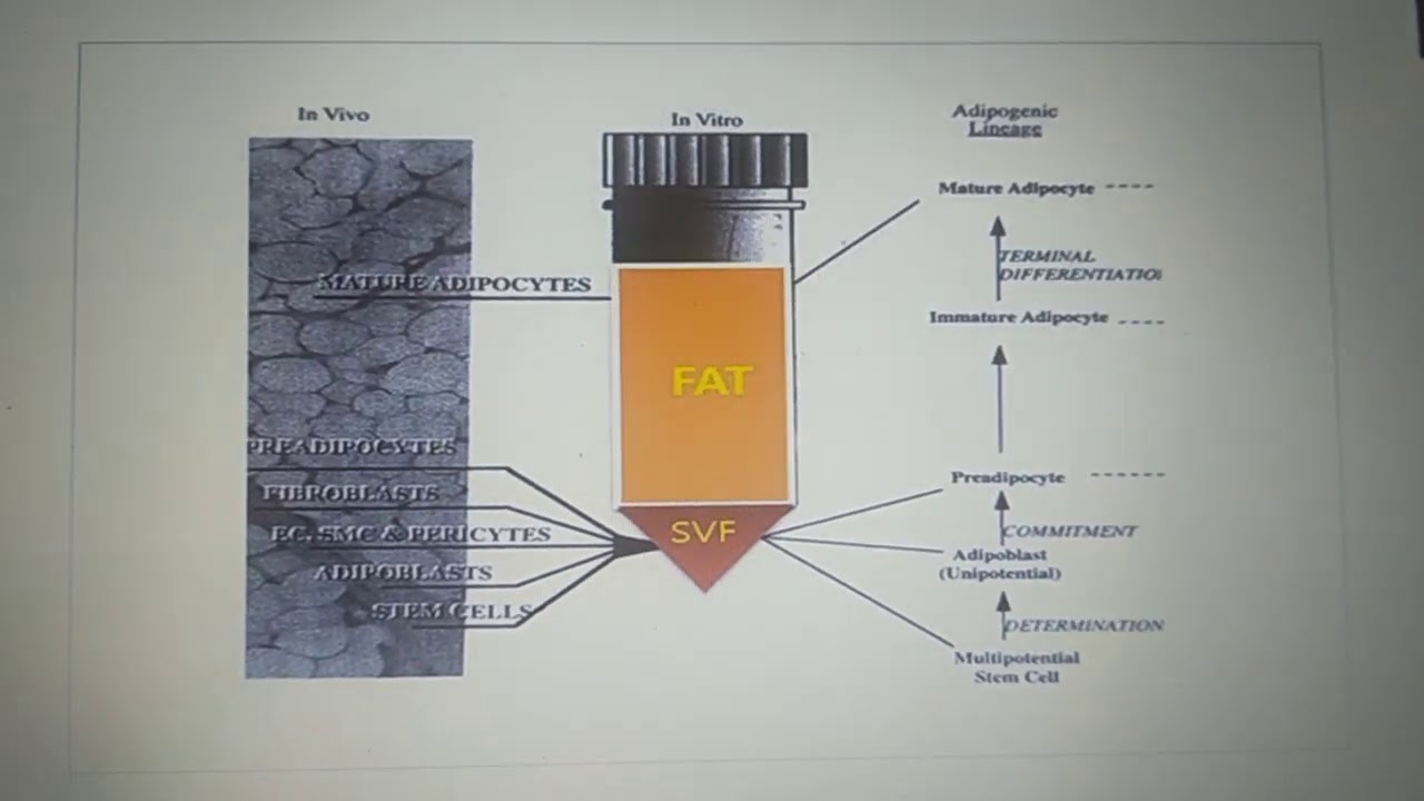 ADSC stem cell/Stromal vascular fraction. - YouTube
